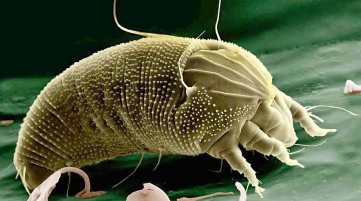 Le sarcopte de la gale (acarien) - SOLUTY