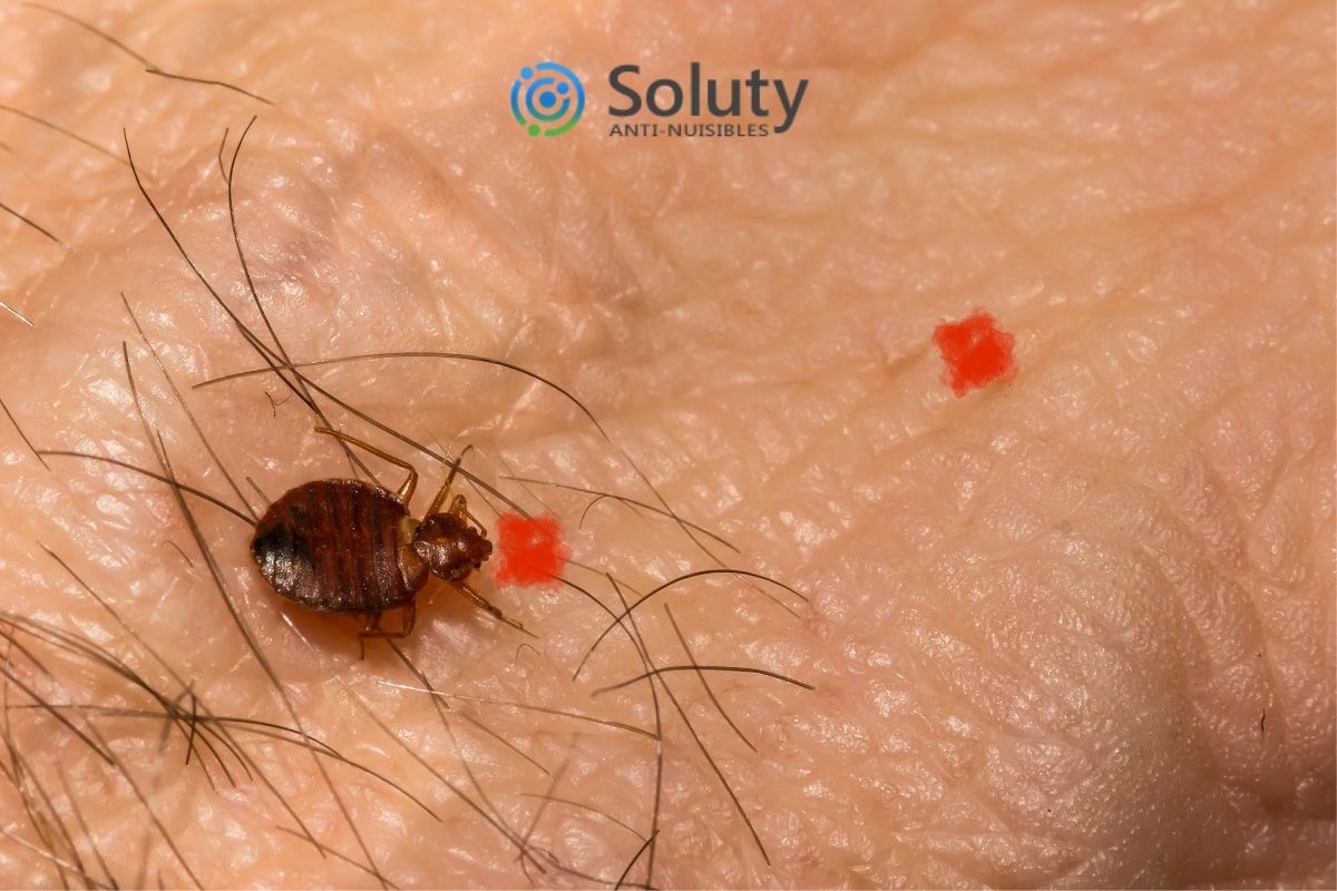 Piqûres de punaises de lit : symptômes, traitement et prévention - SOLUTY
